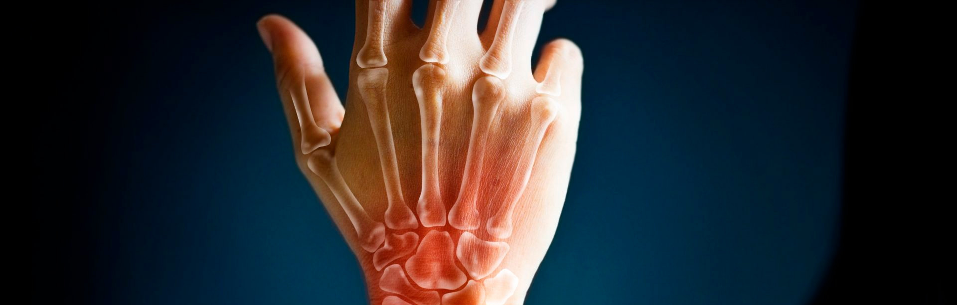 mano | MedCorp - Productos para procedimientos médicos